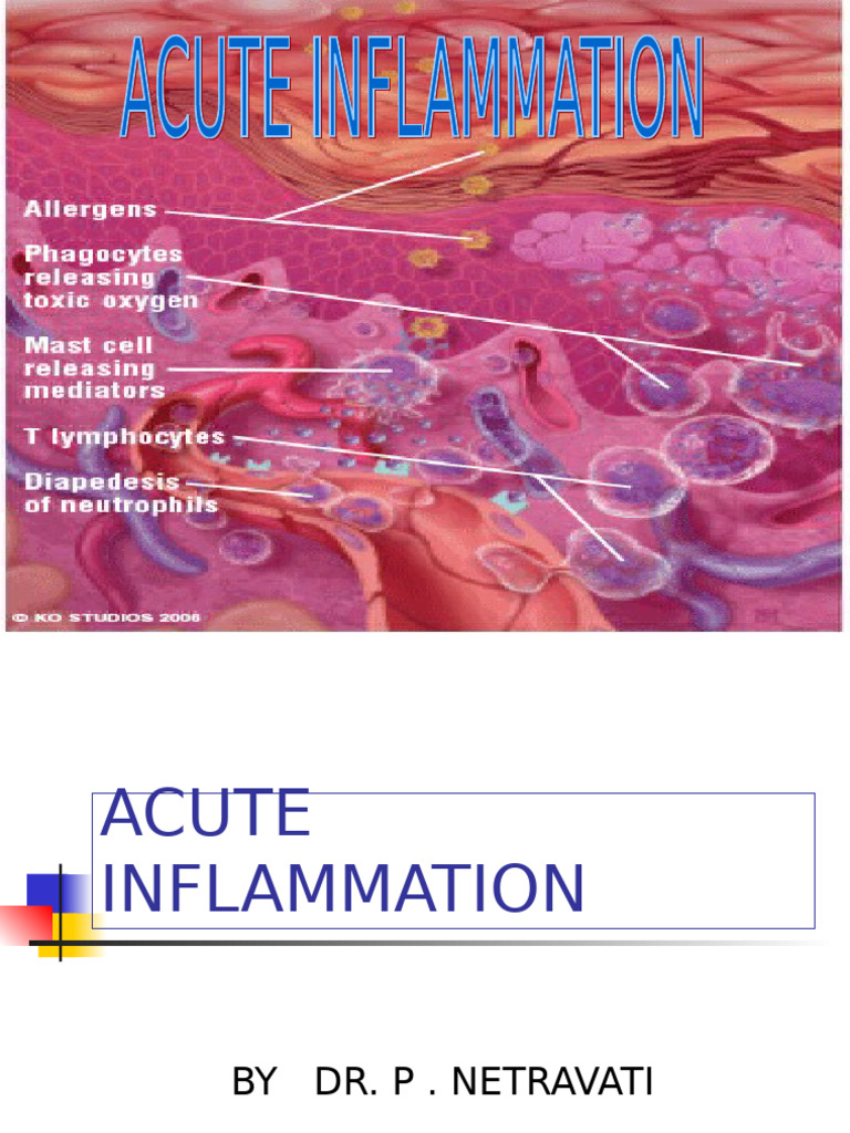 Acute Inflammation | PDF | Inflammation | Capillary