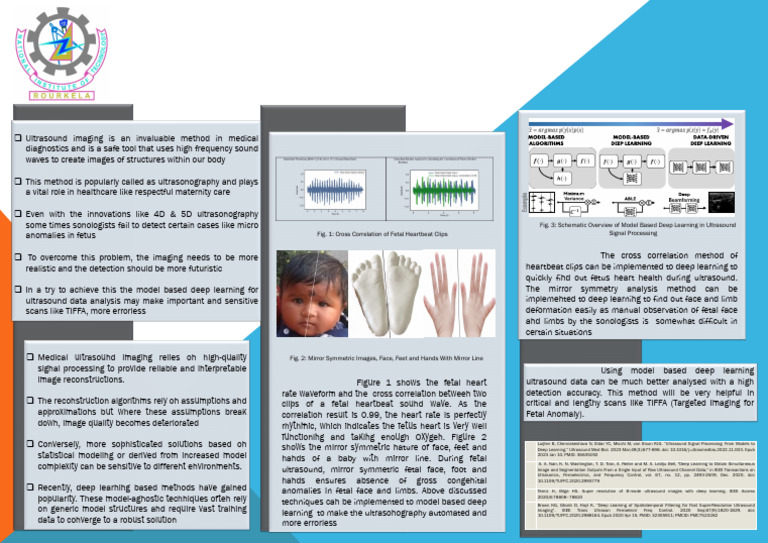 ULTRASOUND DATA ANALYSIS USING MODEL BASED DEEP LEARNING POSTER NIT ROURKELA | PDF | Ultrasound ...