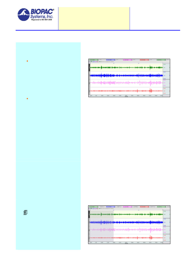 L03 Analysis Procedure | PDF | Electroencephalography