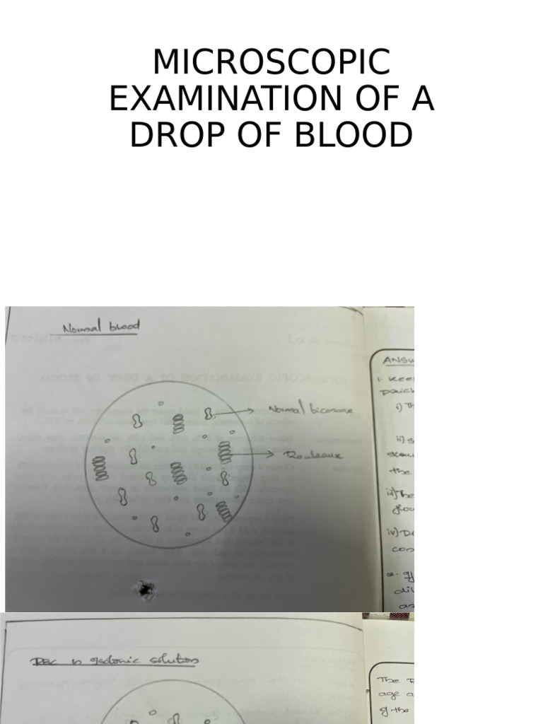 Microscopic Examination of A Drop of Blood | PDF