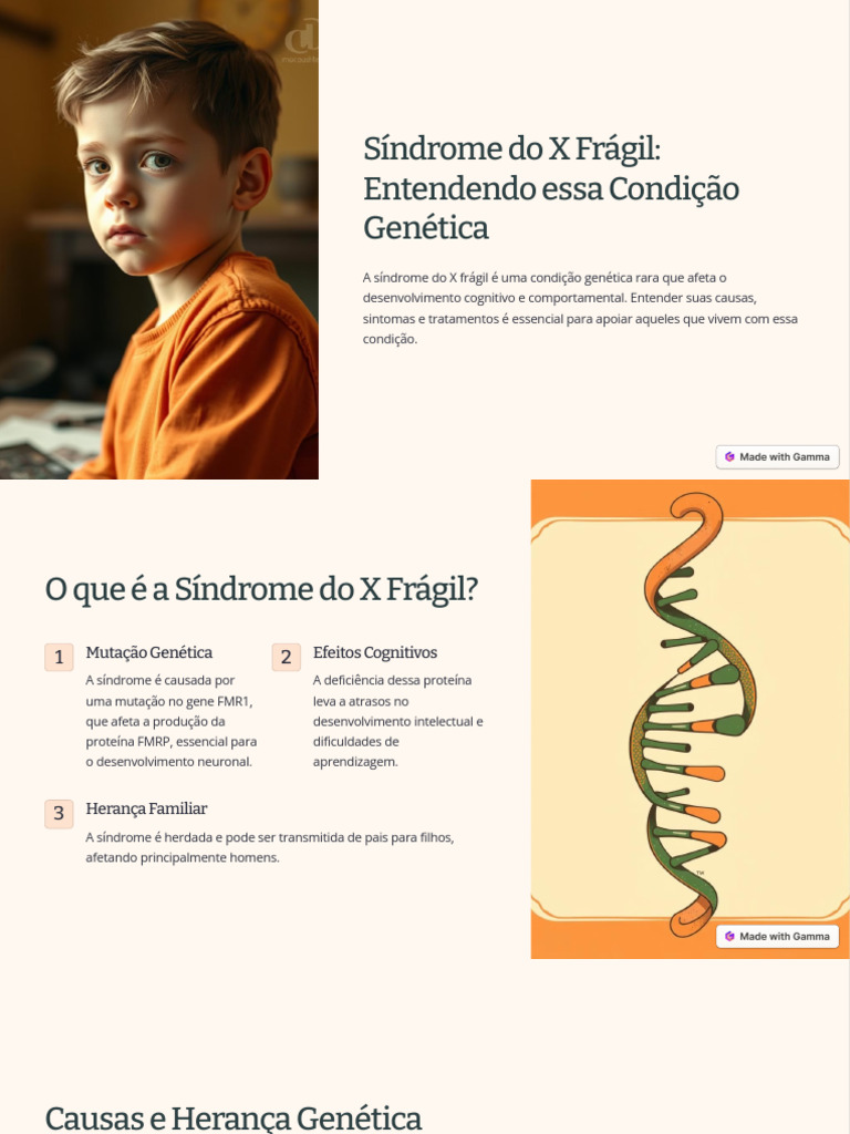 Sindrome Do X Fragil Entendendo Essa Condicao Genetica | PDF | Doenças ...