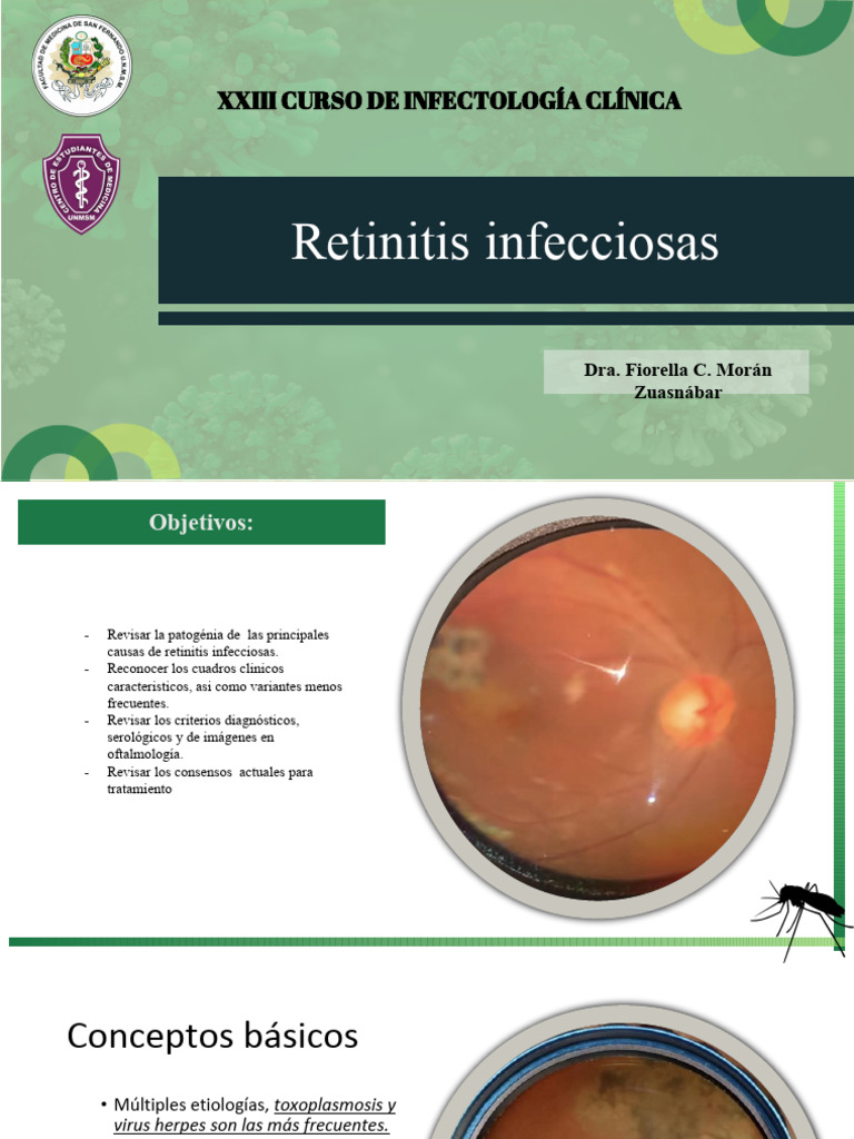 Retinitis Infecciosas: Diagnóstico y Tratamiento | PDF | Sistema inmune ...