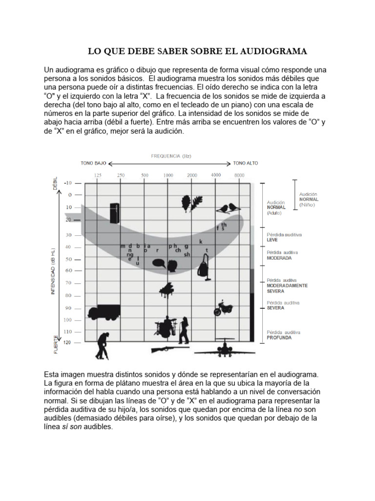 All About The Audiogram SP Bitts | PDF