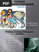 MCU vs RGU: Procedures and Indications | PDF | Urinary System | Urology