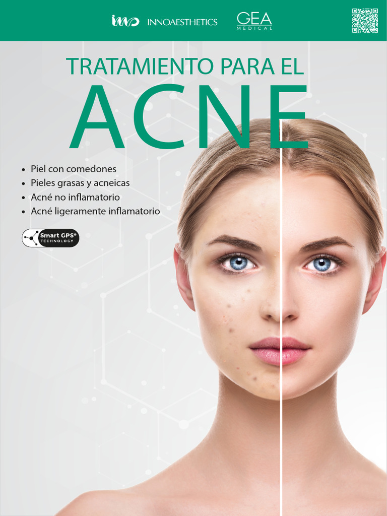 Akn Resultados V1 Edit | PDF