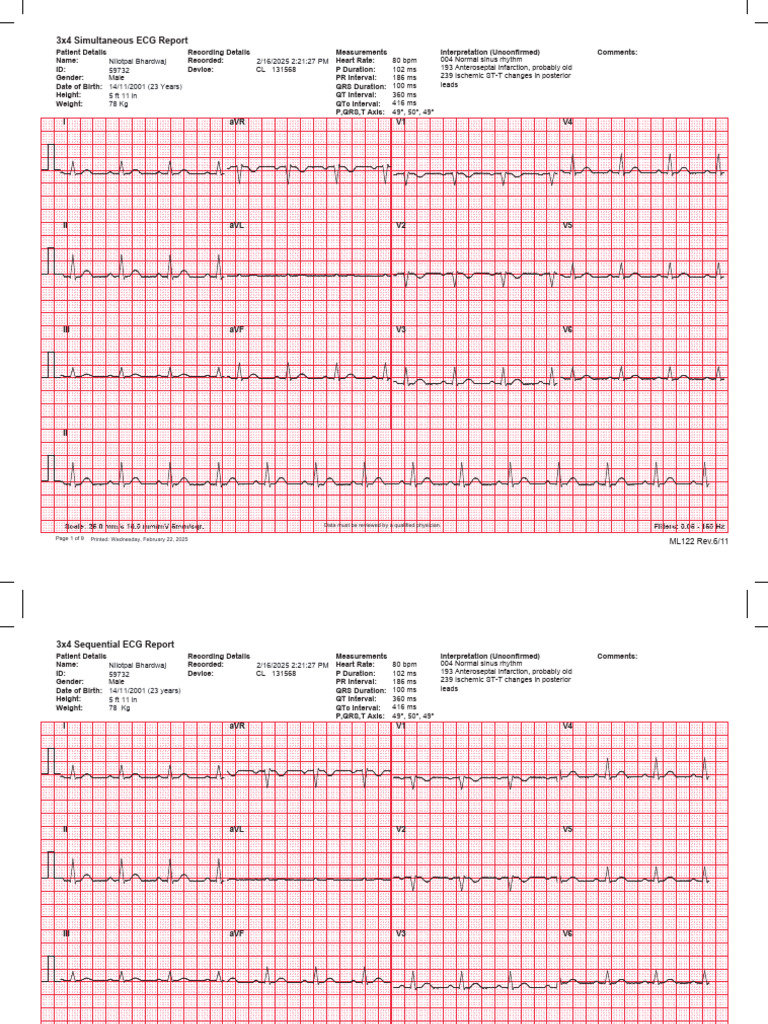 ECG Sample Report Rotated | PDF | Electrocardiography | Heart