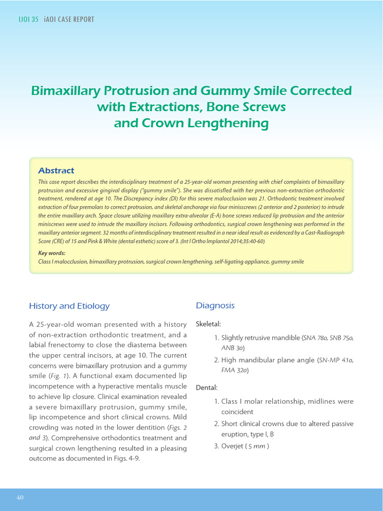 Bimaxillary Protrusion and Gummy Smile Corrected With Extractions, Bone ...