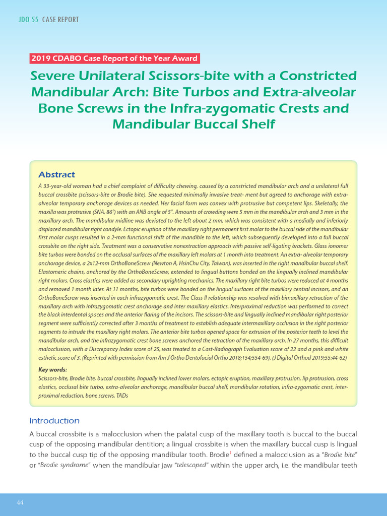 Unilateral Scissors-Bite Treatment Case | PDF | Tooth | Dentistry