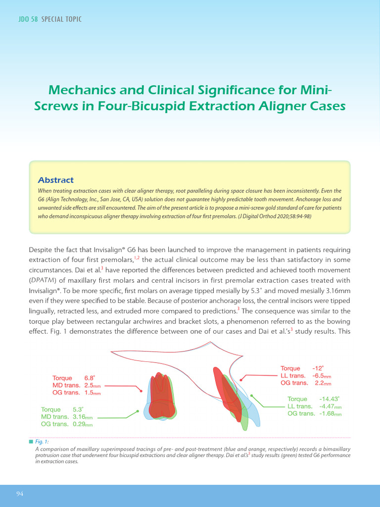 Mechanics and Clinical Significance For Mini Screws in Four-Bicuspid ...