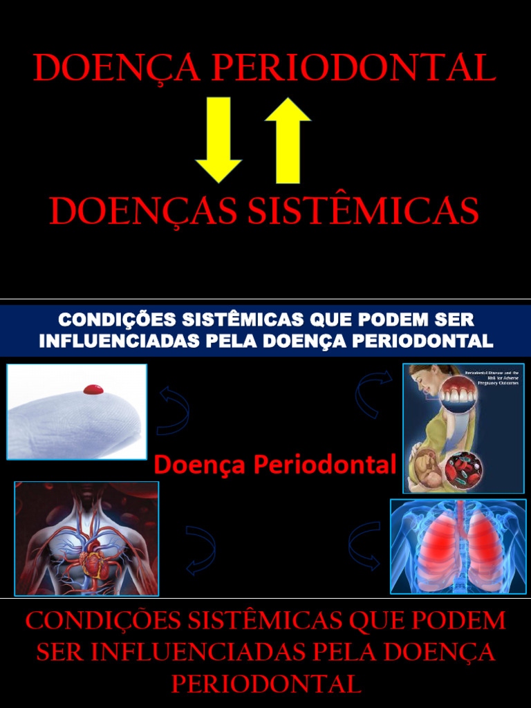 Doença Periodontal e Impactos Sistêmicos | PDF | Aterosclerose | Diabetes