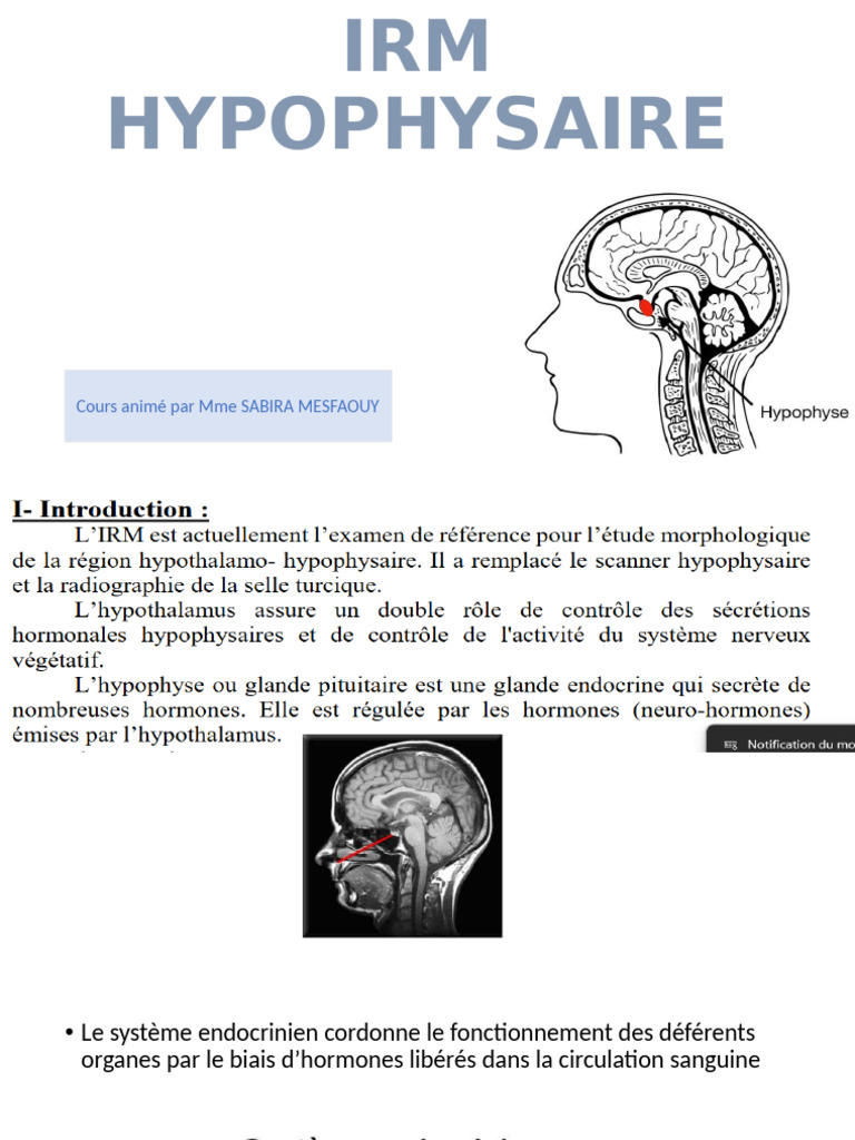 14-10-2024 Cours Irm Hypophysaire | PDF