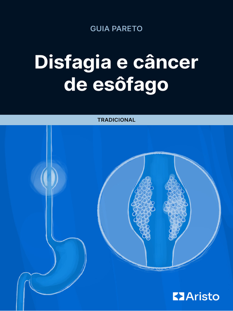 Disfagia e Câncer de Esôfago: Guia Completo | PDF | Câncer de esôfago ...