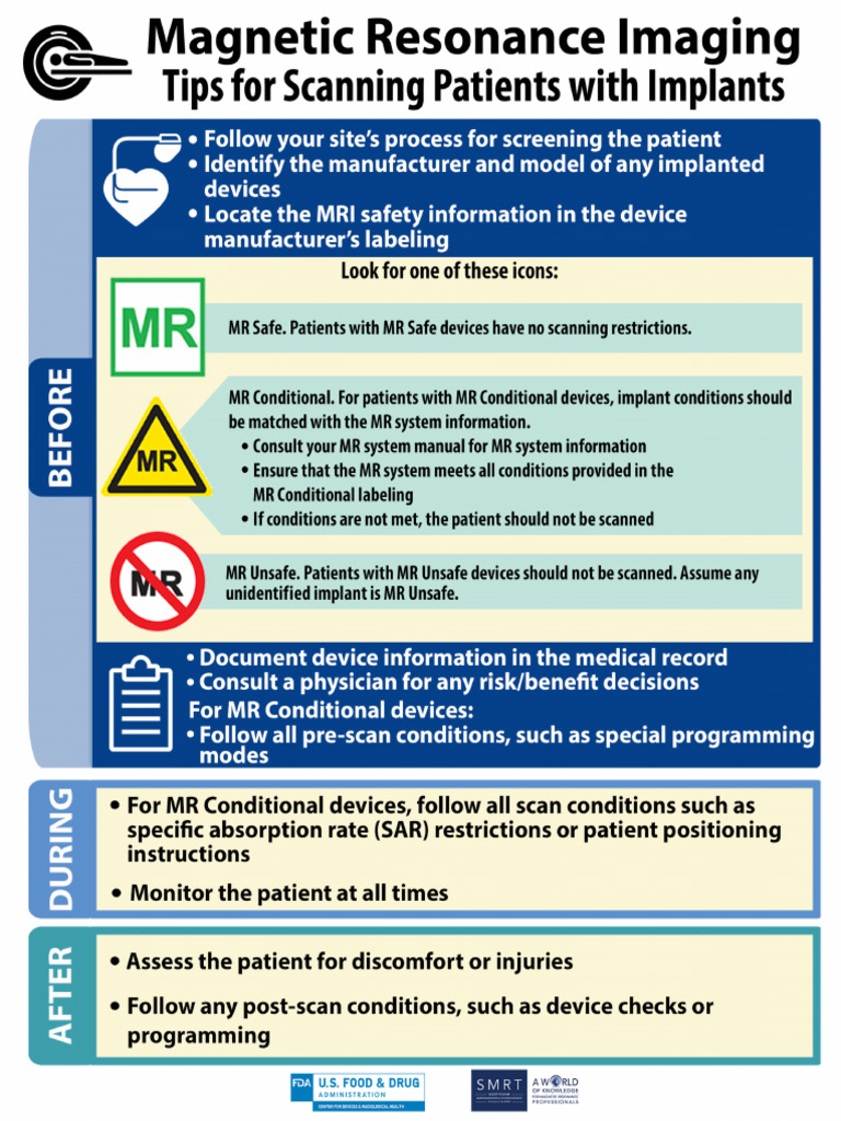 MRI Tips For Scanning Patients With Implants Poster (11in X 14in) | PDF