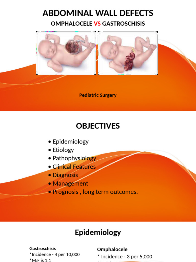 Omphalocele vs Gastroschisis Overview | PDF | Medical Specialties ...