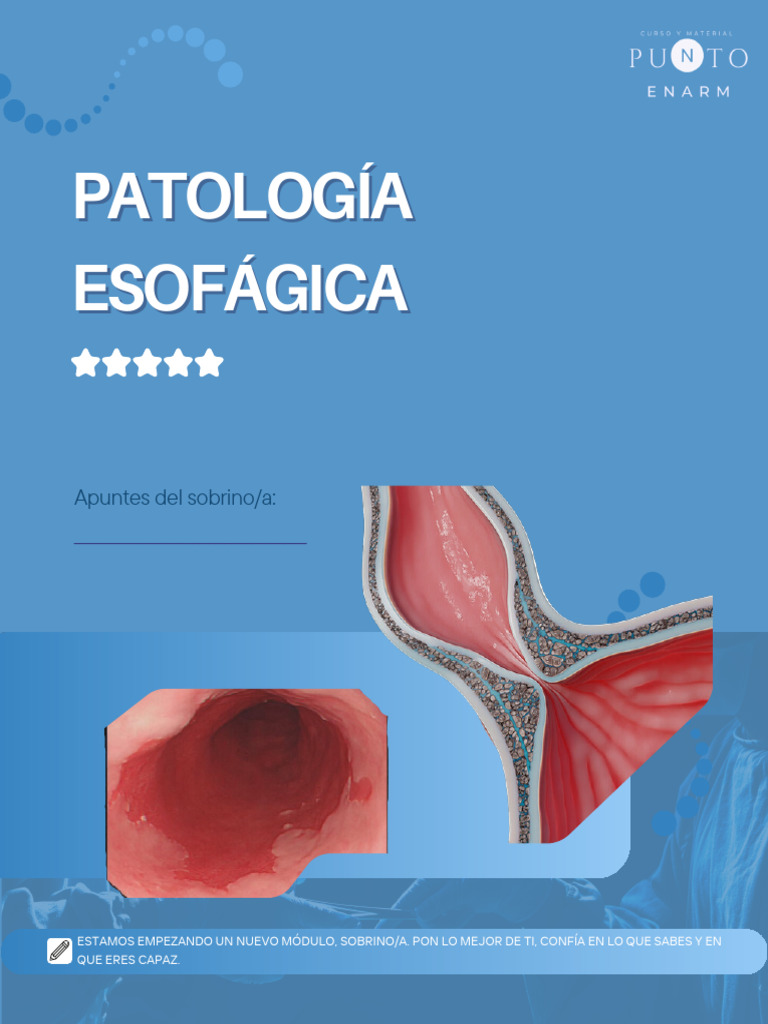 Patologías Esofágicas: Diagnóstico y Tratamiento | PDF | La enfermedad ...