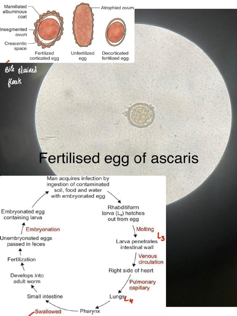 Stool examination micro | PDF