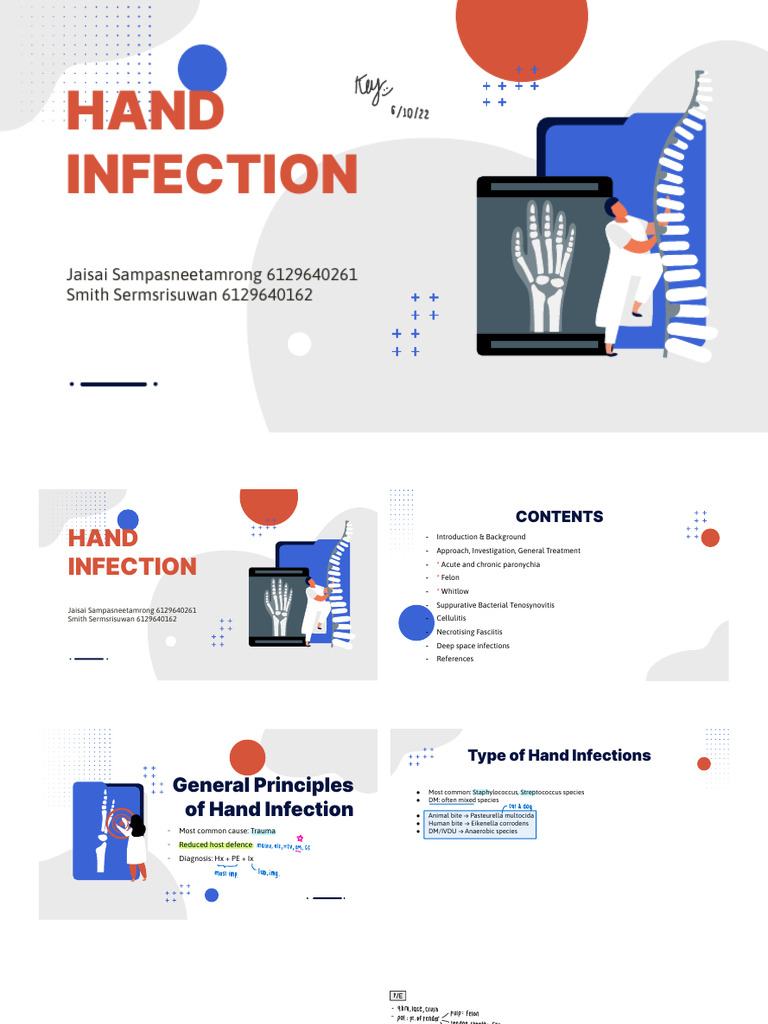 17 Hand Infection | PDF | Microbiology | Clinical Medicine