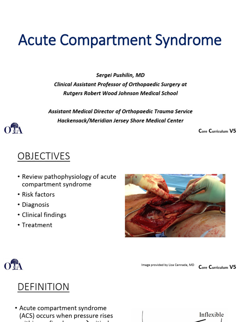 Acute Compartment Syndrome | PDF | Medicine | Injury