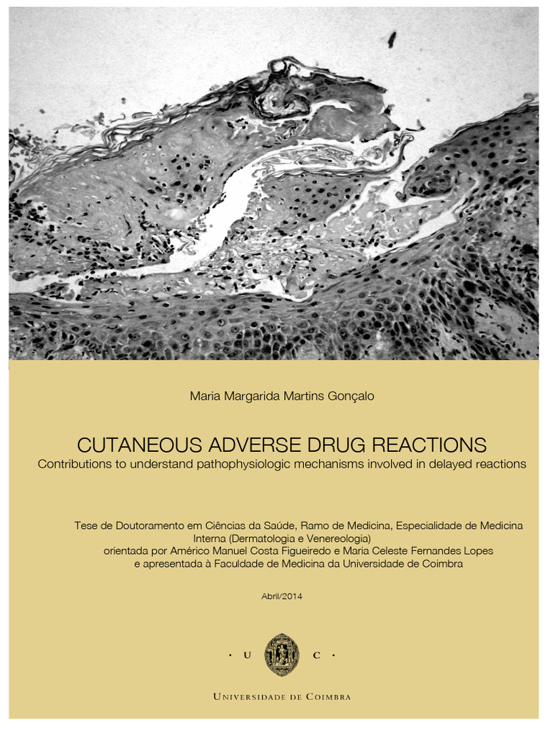 Understanding Delayed Drug Reactions | PDF | T Helper Cell | Immunology