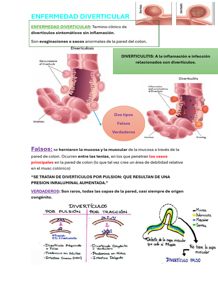Enfermedad Diverticular: Síntomas y Complicaciones | PDF | Enfermedades ...