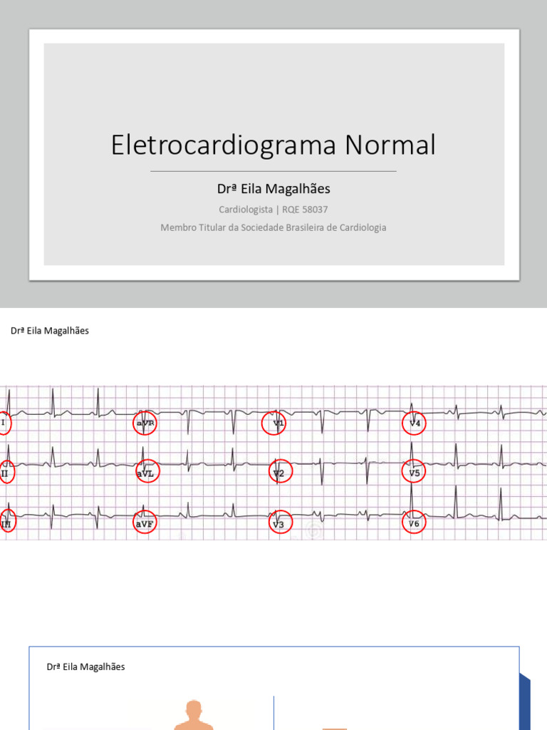 Guia Completo de Eletrocardiograma Normal | PDF | Coração | Fisiologia ...