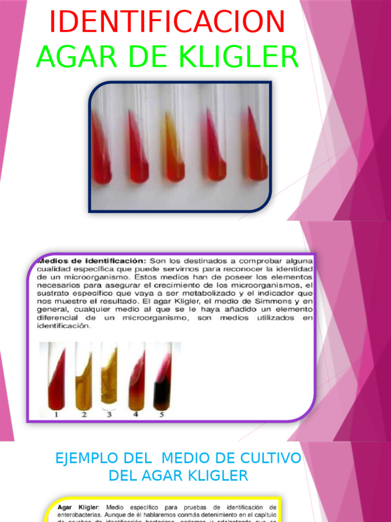 Agar de Kligler: Fermentación y Resultados | PDF