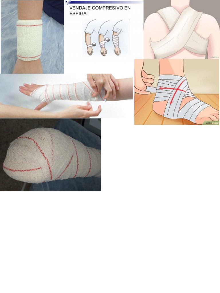 vendajes | PDF