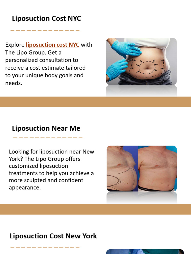 Liposuction Cost in NYC Explained | PDF