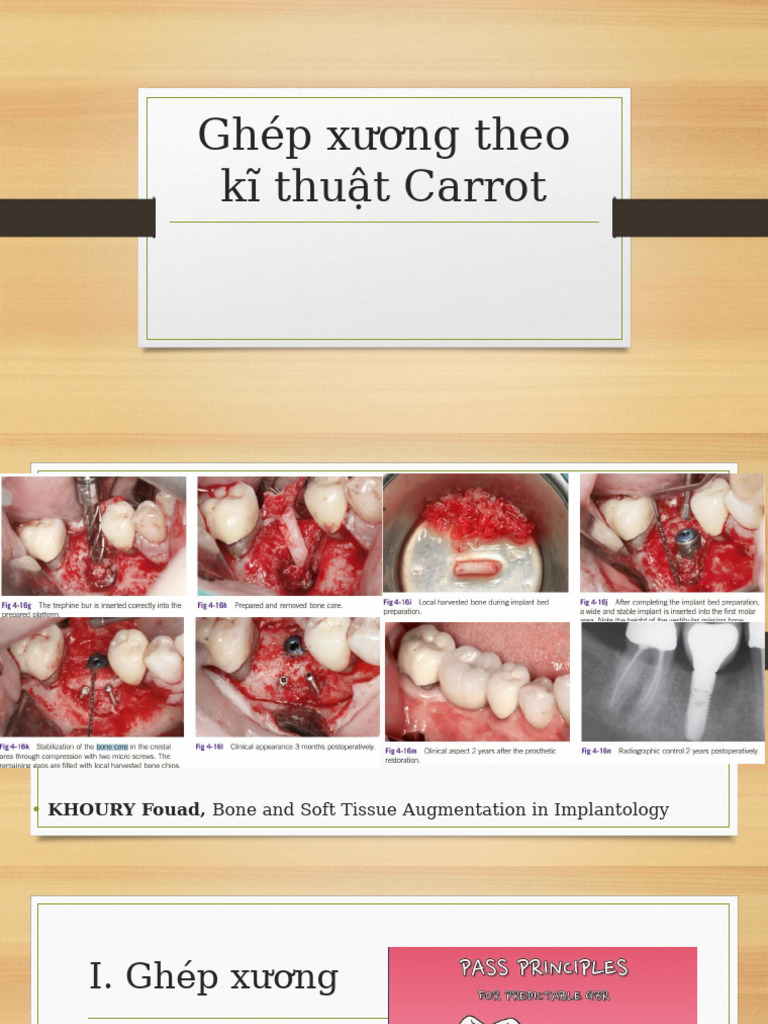 Carrotta 2 | PDF