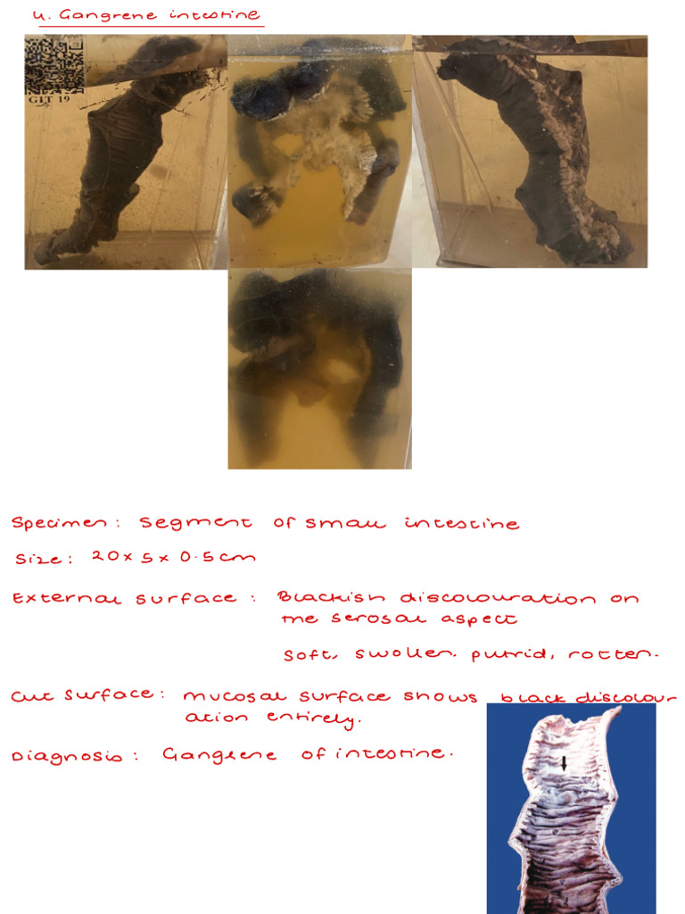 Pathology Specimens | PDF