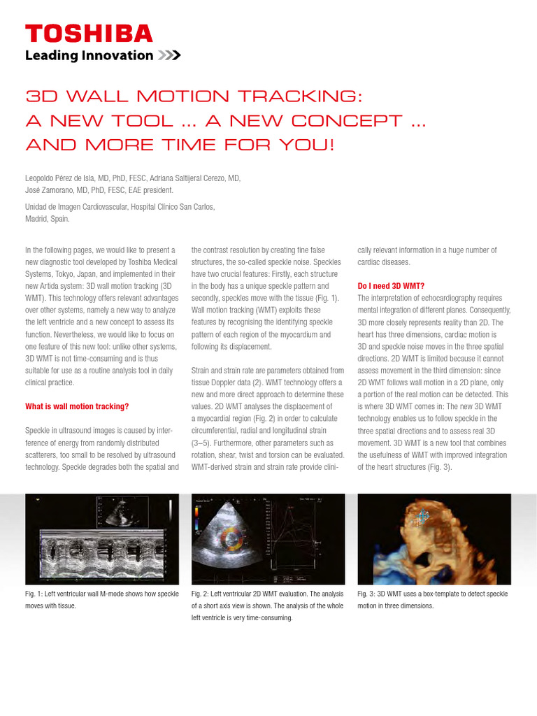 3D Wall Motion Tracking for Cardiac Analysis | PDF | Cardiovascular ...