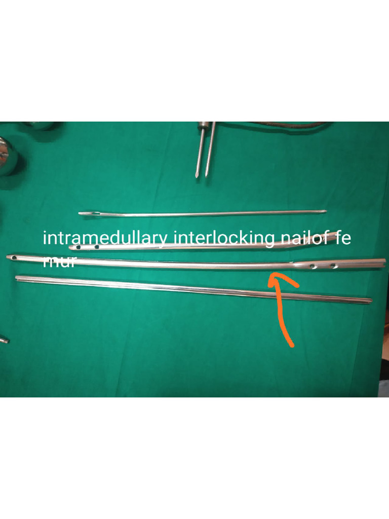 Ortho Instruments and Xrays | PDF