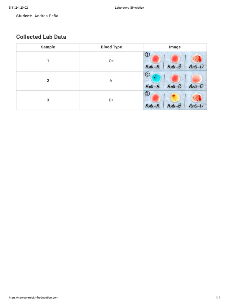 Blood Type Lab Data Summary | PDF