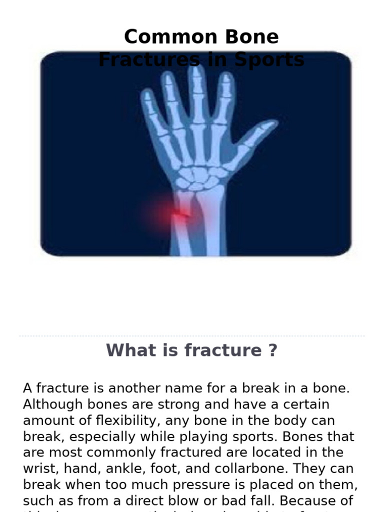 Sports-Related Bone Fractures Guide | PDF | Bone | Clinical Medicine