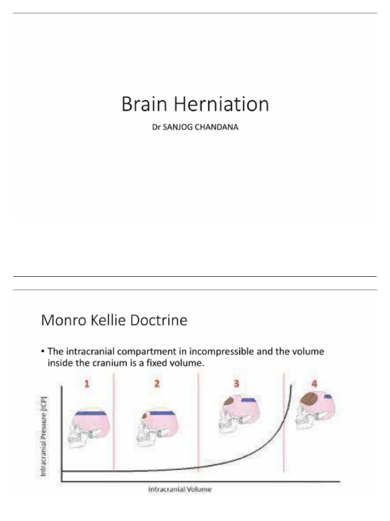 brain herniation | PDF