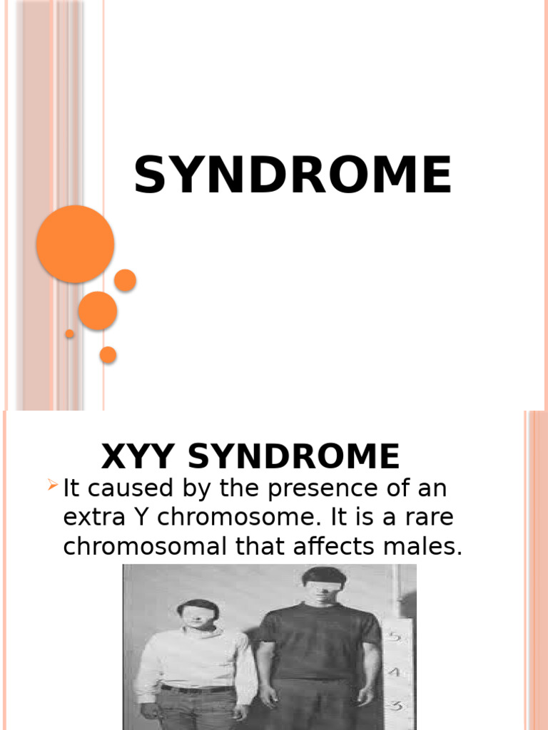Overview of Rare Chromosomal Syndromes | PDF
