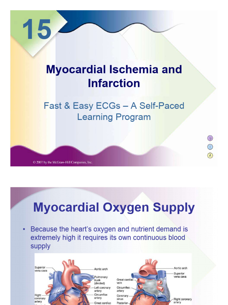 Ischemic Heart Disease ECG | PDF | Coronary Circulation ...