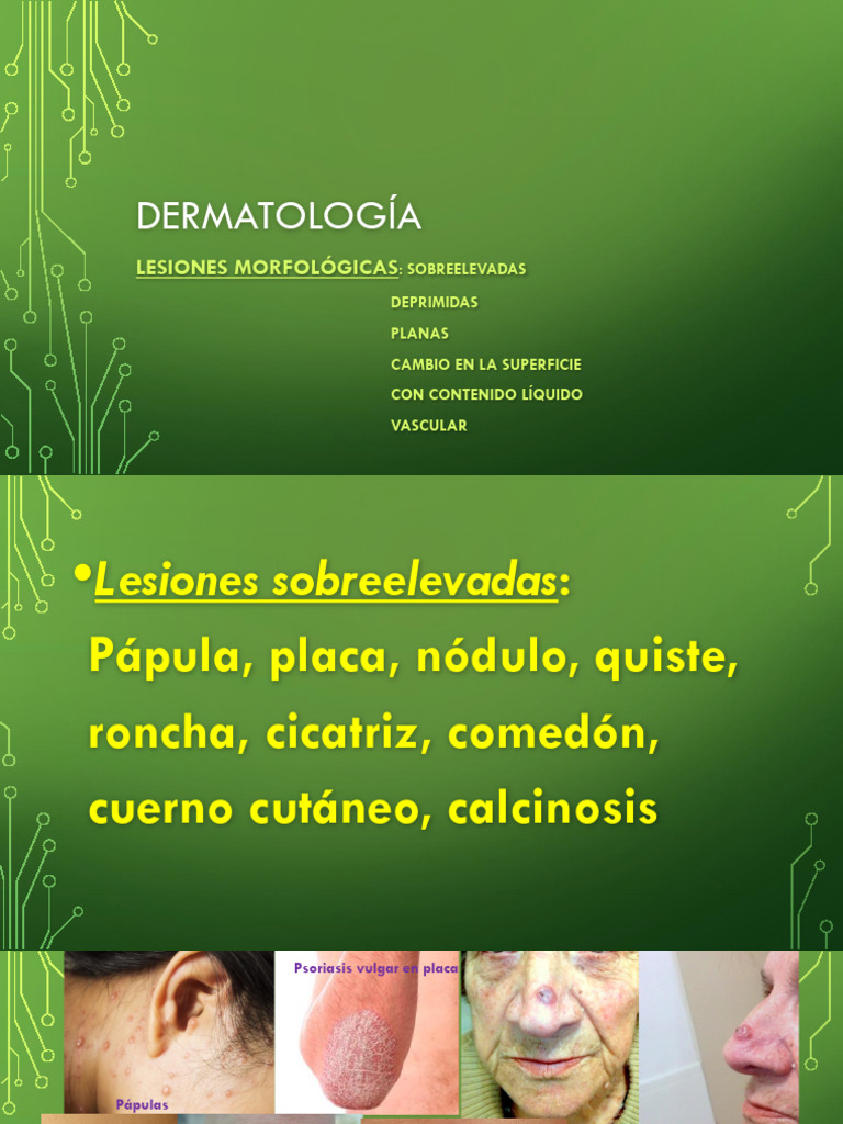Lesiones Cutáneas: Tipos y Características | PDF | Piel | Epidermis