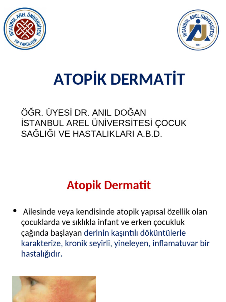 Atopik Dermatit | PDF