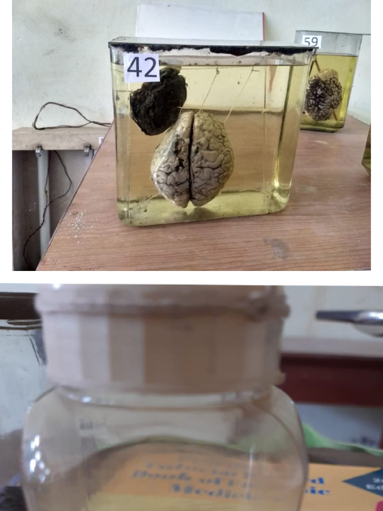 Poison Identification FSM Practical @shamim | PDF