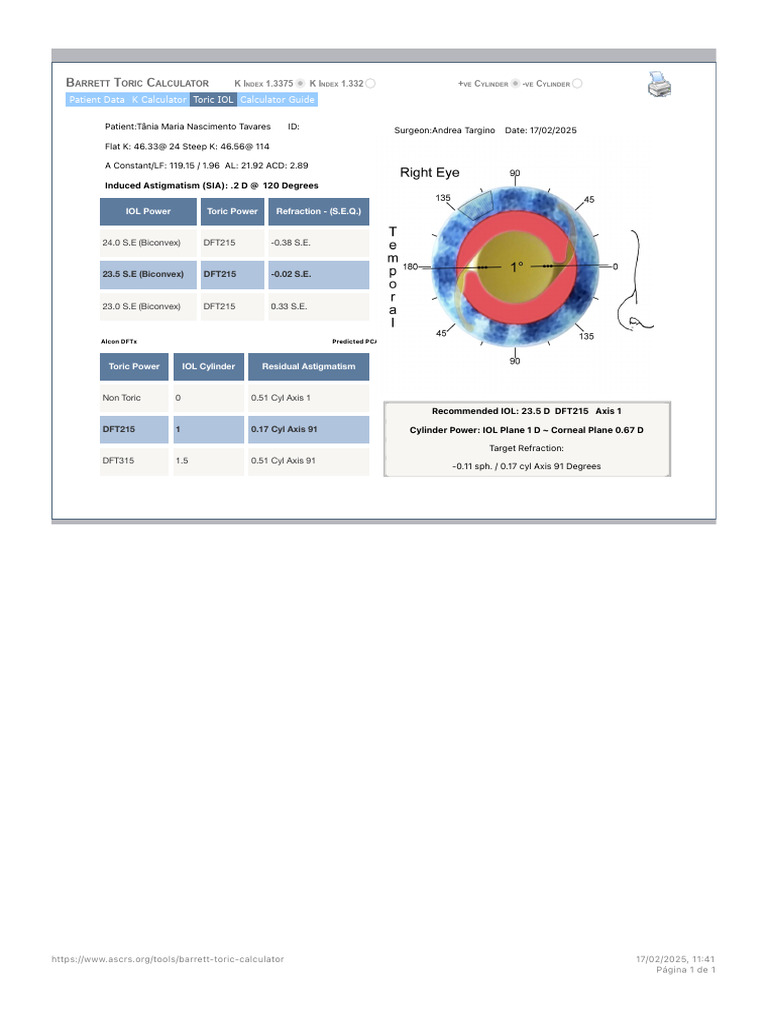 Barrett Toric IOL Calculator Results | PDF