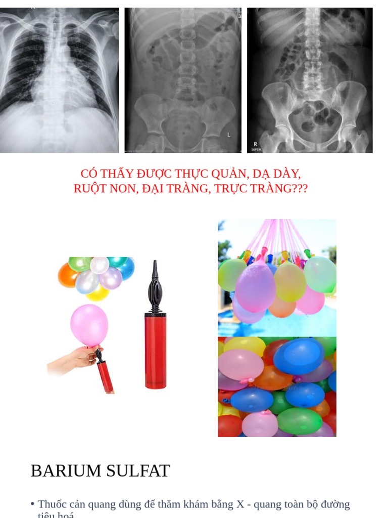 Có Thấy Được Thực Quản, Dạ Dày, Ruột Non, Đại Tràng, Trực Tràng??? | PDF