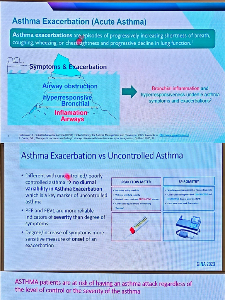 The role and benefit fluticason propinonat nebul in acute Asthma | PDF