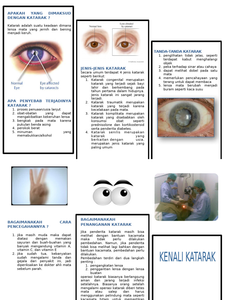 Leaflet Katarak | PDF