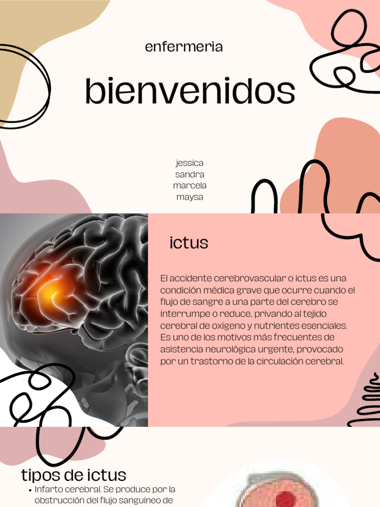 Ictus | PDF