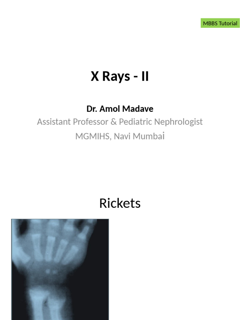 X Rays Peds | PDF
