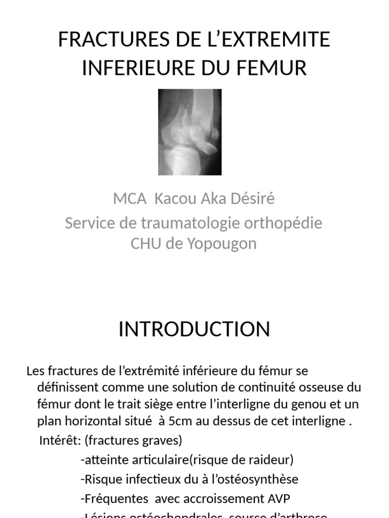 Fractures du fémur : diagnostic et traitement | PDF | Jambe humaine | Genou