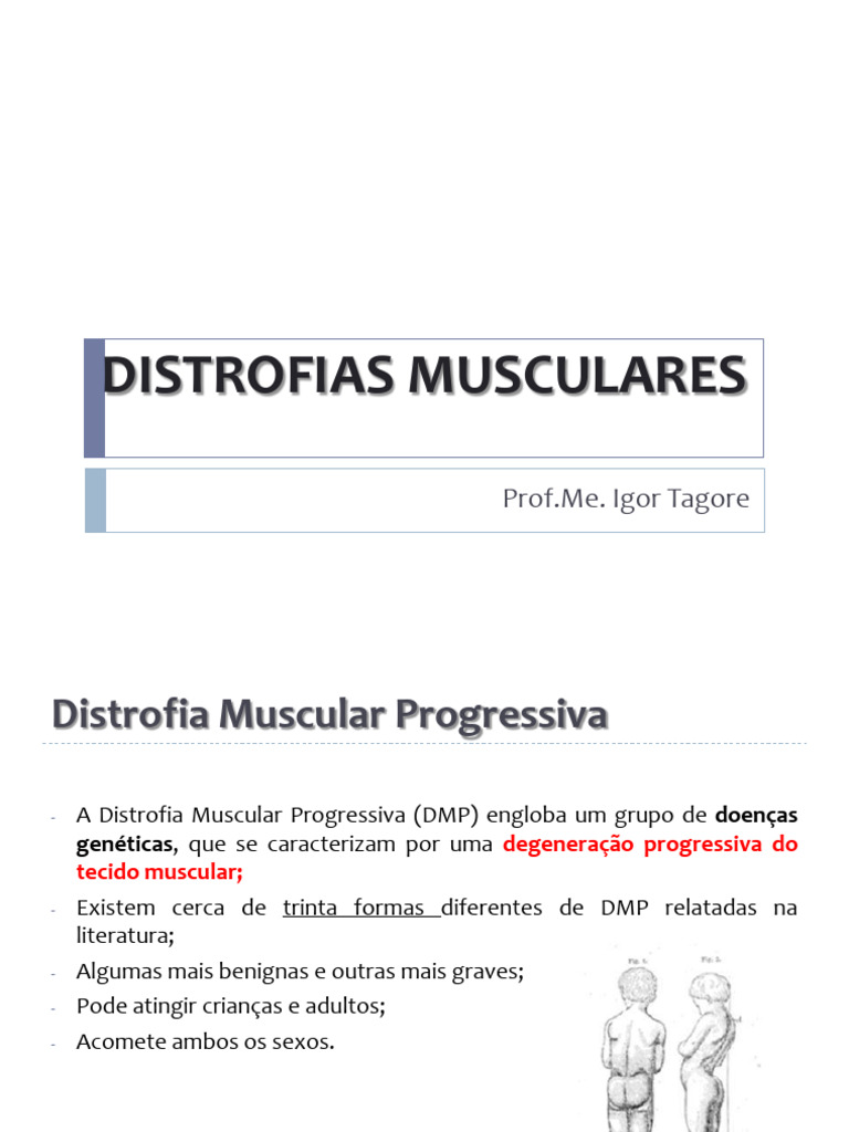 Distrofias Musculares: Duchenne e Tipos | PDF