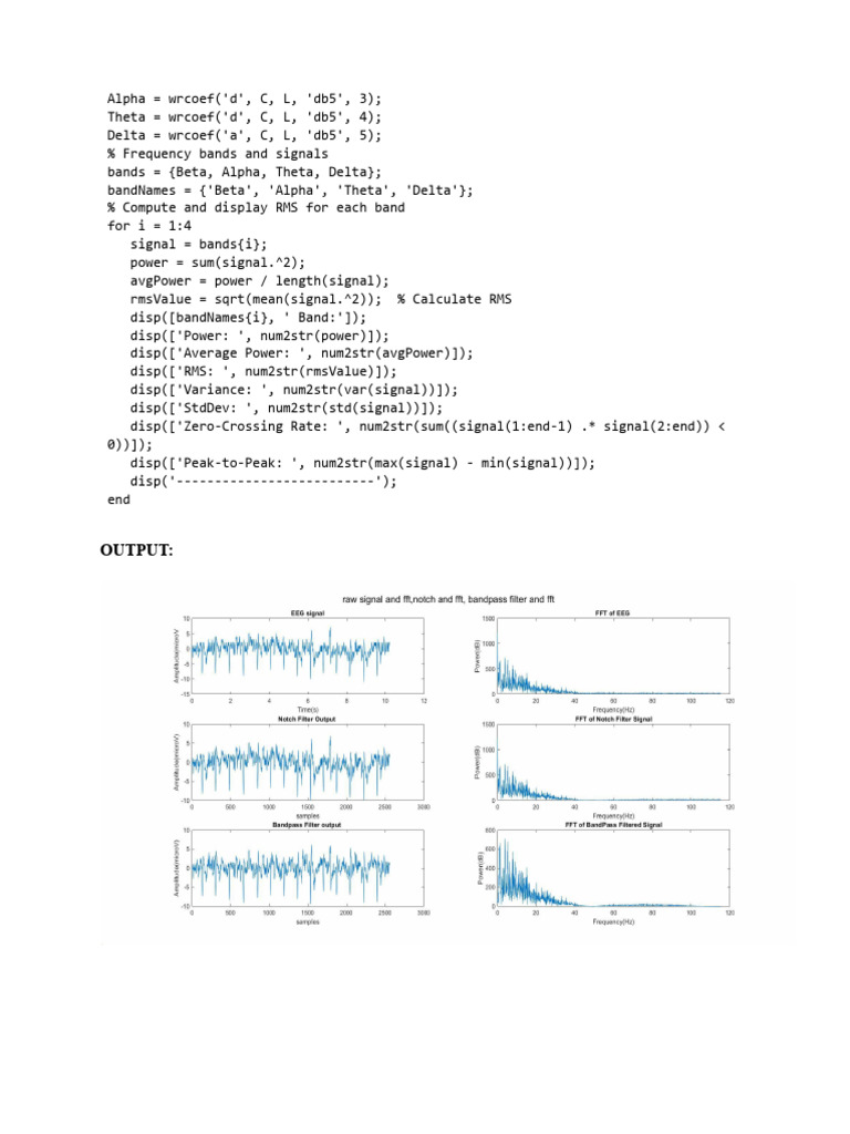 BAND SEPARATION AND SPECTRUM OF EEG SIGNALS__removed | PDF