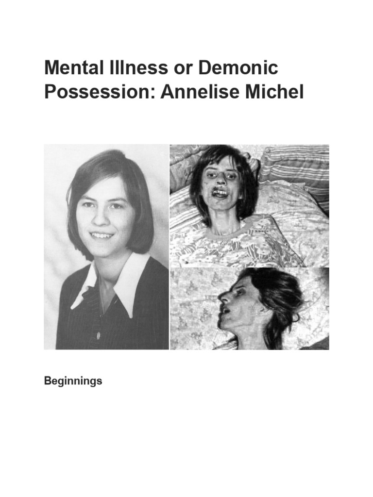 Mental Illness or Demonic Possession | PDF